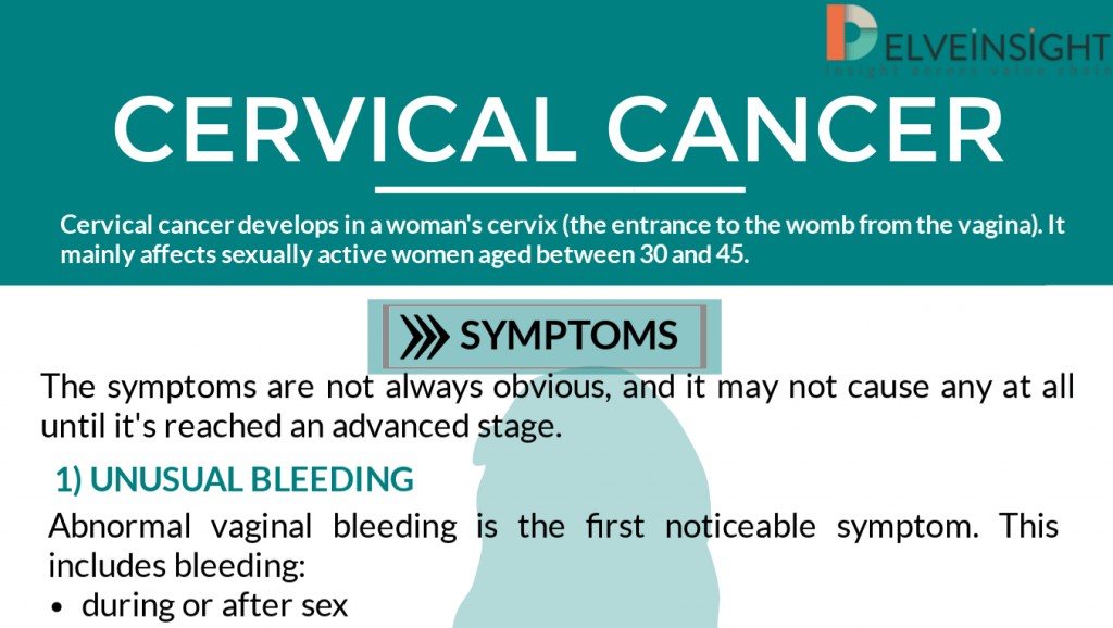 Cervical cancer | DelveInsight Business Research