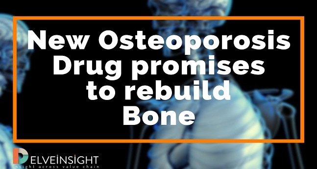 New Osteoporosis Drug promises to rebuild Bone | DelveInsight