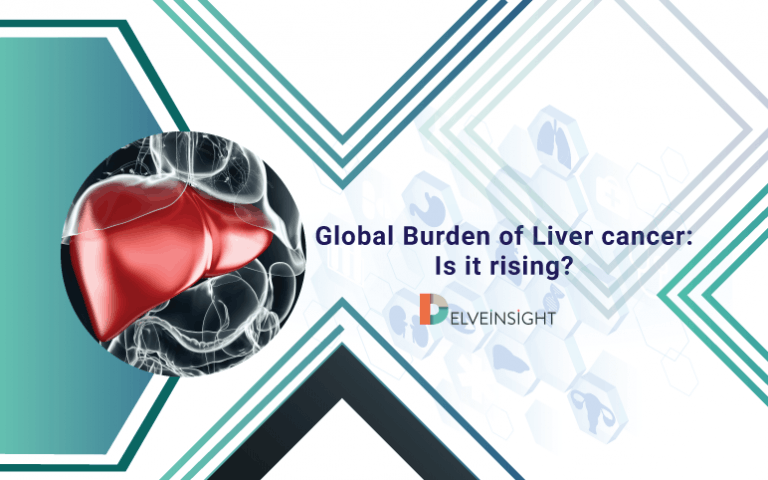 Global Burden of Liver cancer: Is it rising? ﻿ | DelveInsight